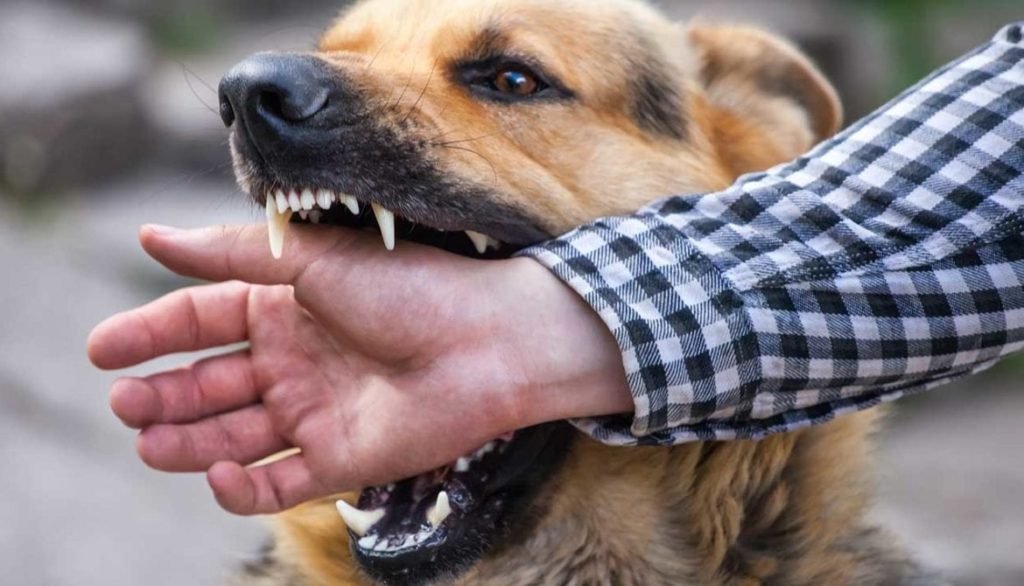 5 Steps to Take After a Dog Bite » Residence Style